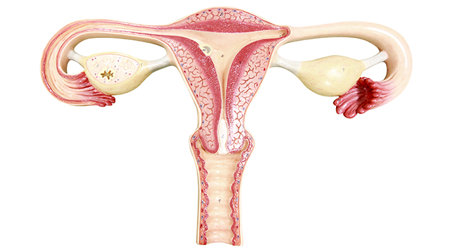 Apa itu Kista? Gejala, Penyebab, Pengobatan & Pencegahan