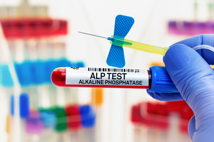 Tes Level Alkaline Phosphatase (ALP)