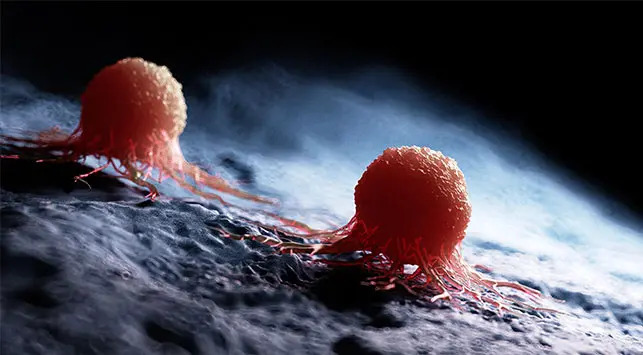 Apa Itu Limfoma? Gejala, Penyebab, dan Pengobatan