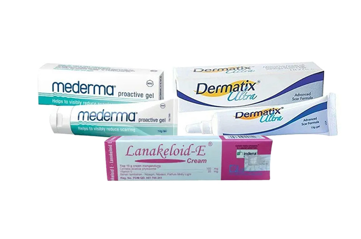 Berbagai Jenis Pengobatan untuk Mengatasi Keloid di Tubuh