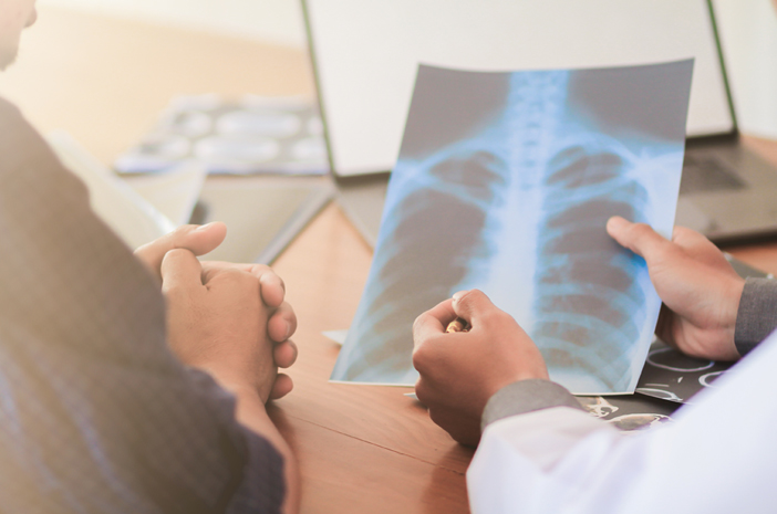 4 Prosedur Terapi Kanker Paru-paru yang Perlu Diketahui