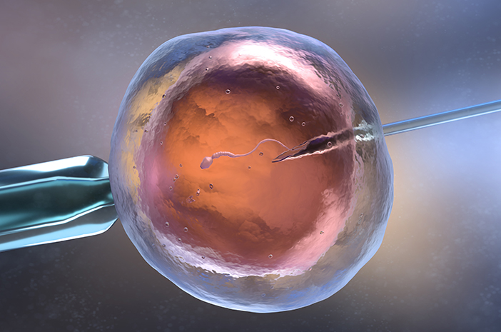 Bagaimana Prosedur Inseminasi Buatan Dilakukan?