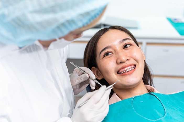 Harga Pasang Behel Gigi: Info Terbaru dan Jenis Behel