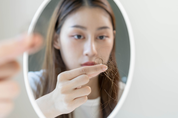 Inilah Alasan Rambut Rontok Kerap Terjadi