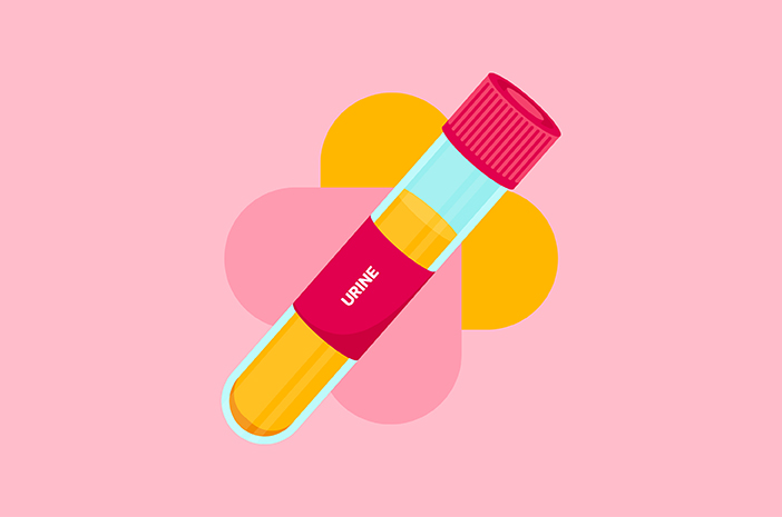 Tes Urine - Tujuan, Prosedur, dan Waktu Melakukannya | Halodoc