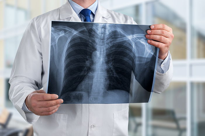 Radiologi - Tujuan, Manfaat, Jenis, dan Prosedur | Halodoc