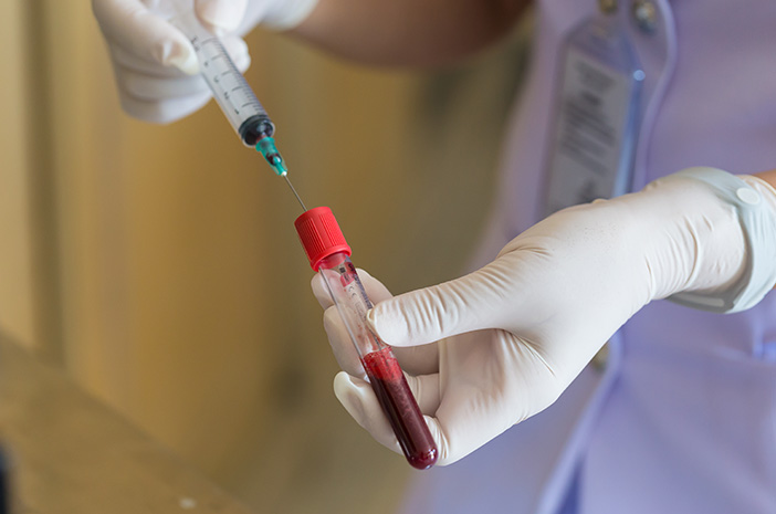 Mengenal Fungsi Trombosit serta Proses Pembentukannya