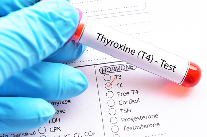 Pemeriksaan FT4 (Free Thyroxine) - Tujuan, Jenis, dan Prosedur | Halodoc Pemeriksaan FT4 (Free Thyroxine) - Tujuan, Jenis, dan Prosedur | Halodoc