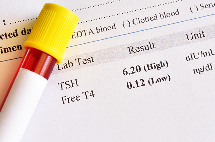 Pemeriksaan TSHs - Tujuan, Manfaat, dan Prosedur | Halodoc