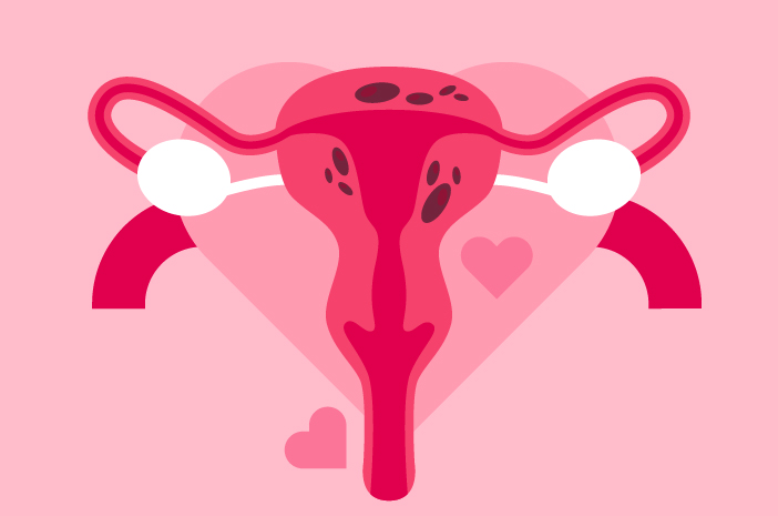 7 Pilihan Penanganan untuk Mengatasi Adenomiosis pada Rahim