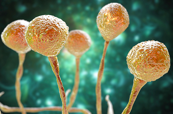 Penanganan Mucormycosis yang Efektif Dilakukan