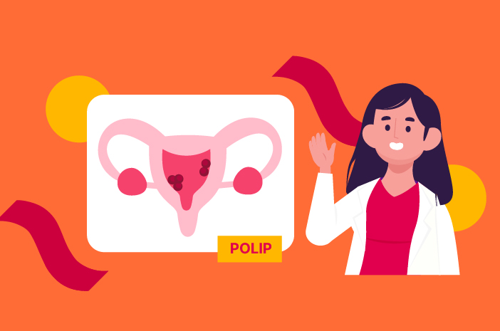 Benarkah Polip Rahim Sebabkan Wanita Sulit Hamil?