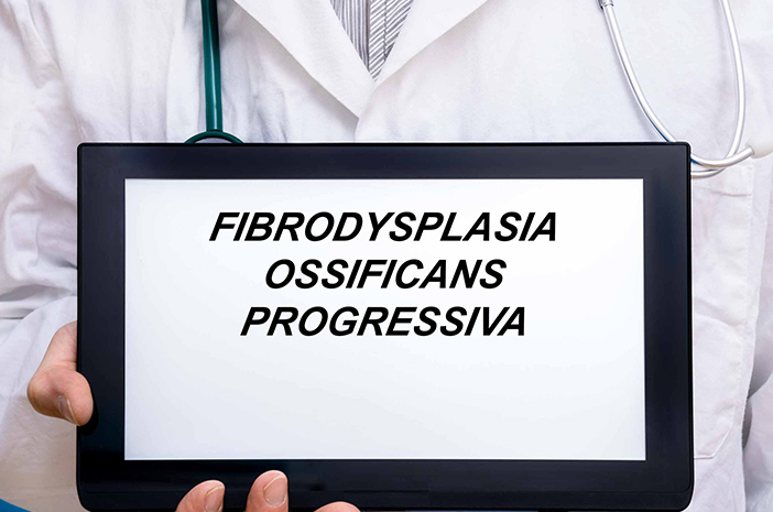 Kenali Awal Terjadinya Stone Man’s Disease pada Tubuh