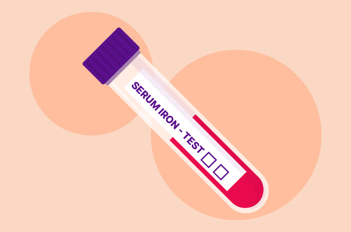 Ukur Kadar Zat Besi, Ini Manfaat Tes Serum Iron bagi Kesehatan