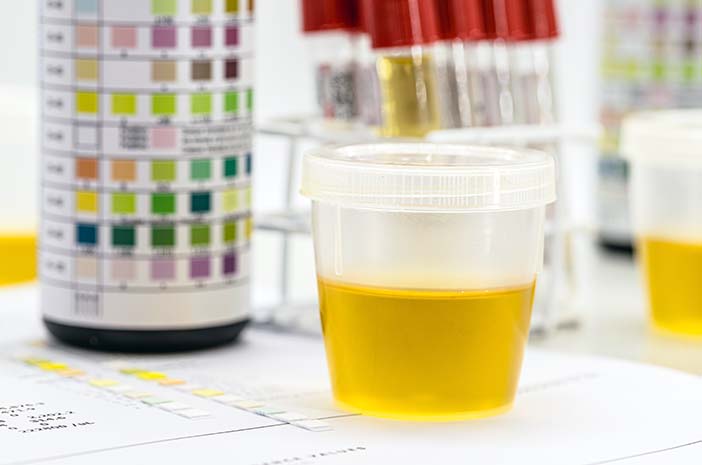 Tes Protein Total, Kapan Perlu Dilakukan? Ini Penjelasannya