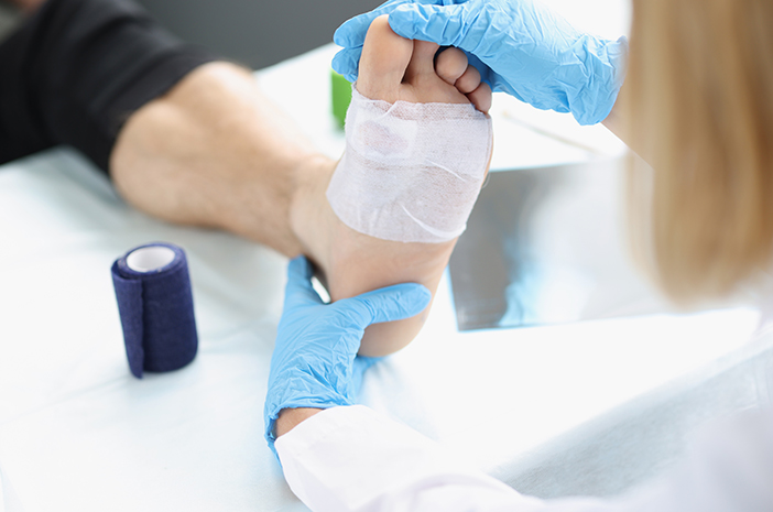 Ini Komplikasi Pyoderma Gangrenosum yang Perlu Diwaspadai