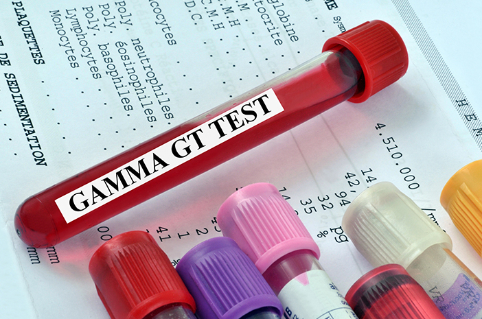 Fungsi Cek Gamma GT untuk Memeriksa Organ Hati