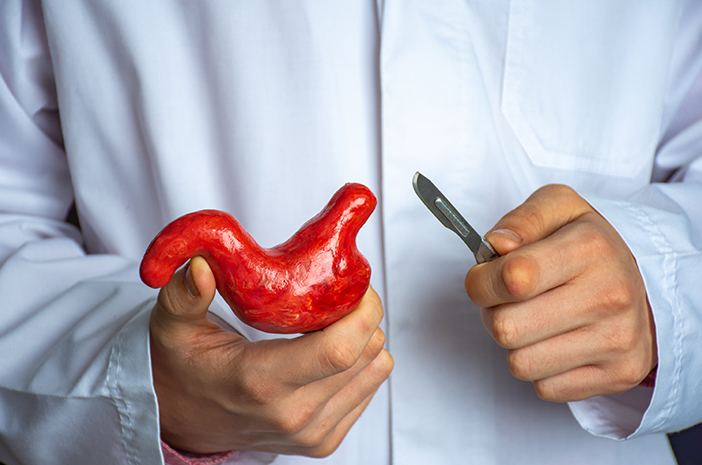 Operasi Bariatrik: Manfaat, Prosedur dan Risiko