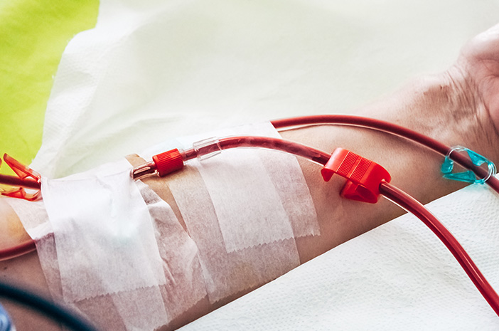 Cimino - Tujuan, Jenis, Prosedur, dan Informasi Lengkap | Halodoc