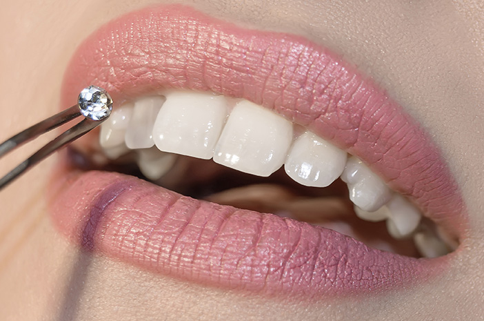 Mitos dan Fakta Seputar Penggunaan Diamond Gigi
