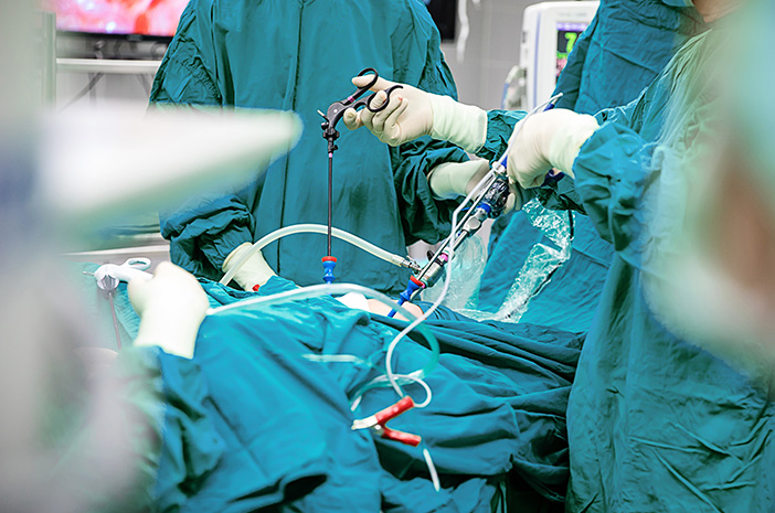 Wajib Tahu, Ini Beda Laparoskopi dan Laparotomi