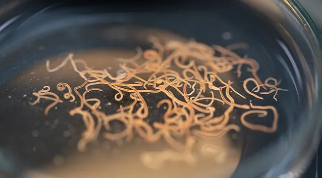 Ini Jenis Cacing Berbahaya yang Bisa Menginfeksi Manusia