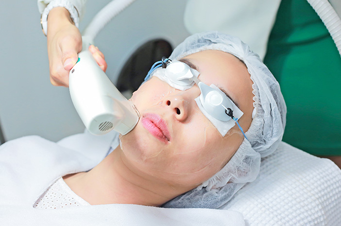 Seberapa Efektif Laser Wajah untuk Hilangkan Bekas Jerawat?