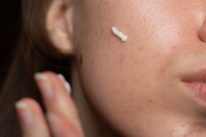 Retinoid Topikal, Pengertian, Fungsi, Efek Samping