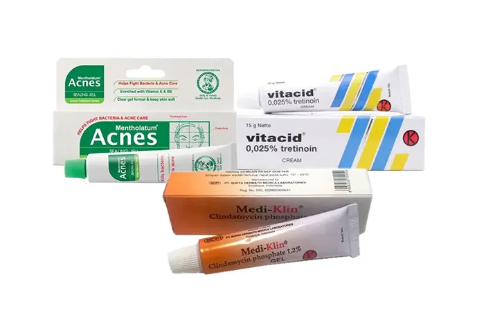 Ini Rekomendasi 5 Obat Jerawat Paling Ampuh di Apotek