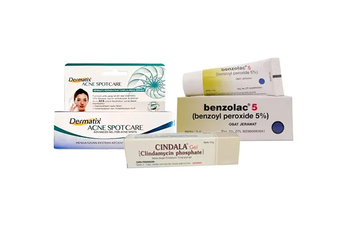 Ini Rekomendasi 5 Obat Jerawat Paling Ampuh di Apotek