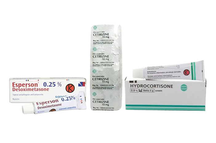 Inilah Obat untuk Mengatasi Eksim yang Kambuh