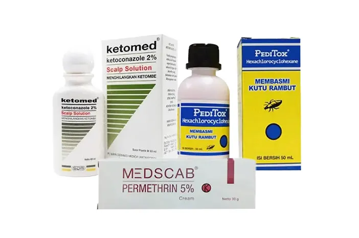 Ini 5 Rekomendasi Obat yang Ampuh untuk Menghilangkan Kutu Rambut