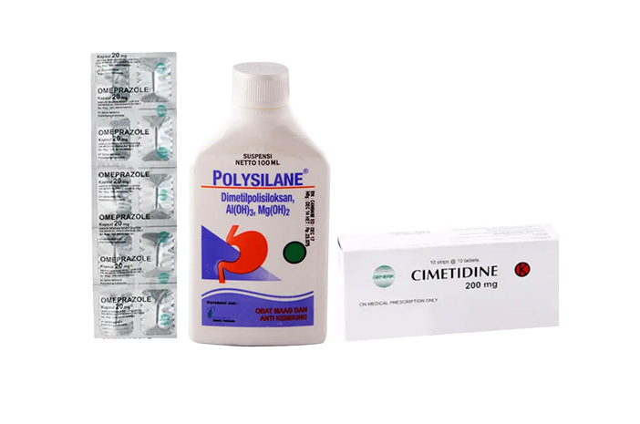Ini Obat GERD Paling Ampuh yang Kerap Diresepkan Dokter