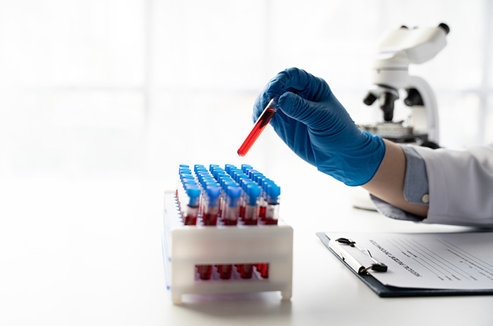 Fakta tentang Golongan Darah dan Rhesus yang Perlu Diketahui