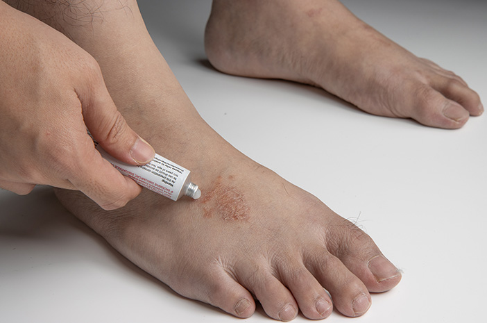 Clotrimazole - Kandungan, Dosis & Efek Samping