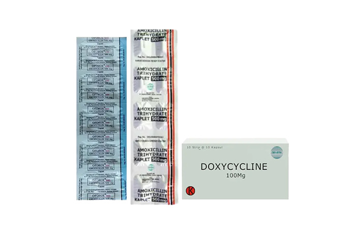 Ini 5 Rekomendasi Antibiotik untuk Sakit Gigi