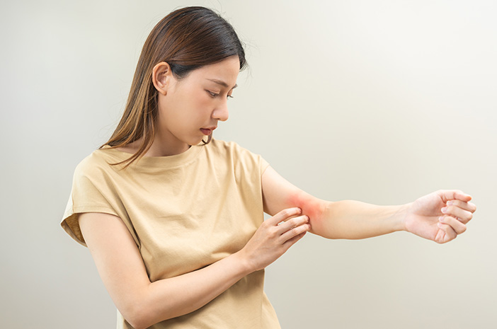 Alami Bintik Merah Gatal Menyebar di Tubuh? Ini Penyebab dan Cara ...