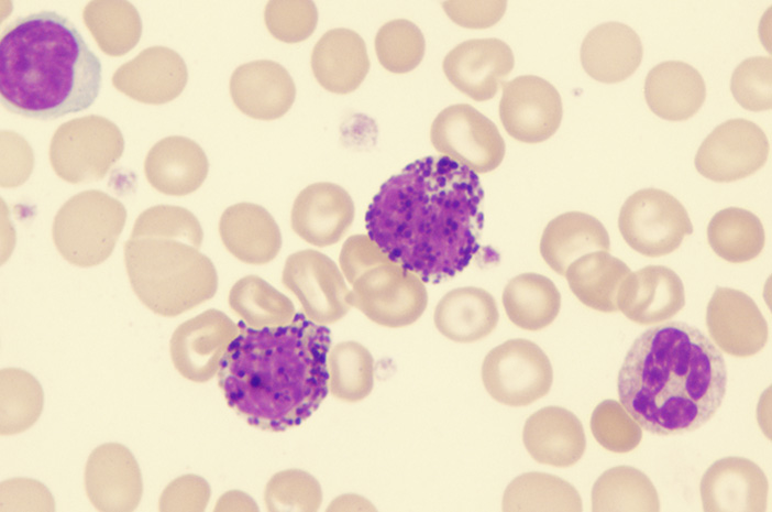 Mengenal Basofil, Salah Satu Jenis Sel Darah Putih