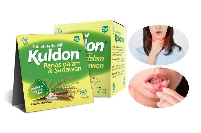 Ini 7 Rekomendasi Obat Sariawan yang Ampuh dan Mudah Ditemukan