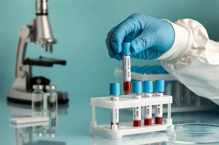 Ini Varian-Varian Coronavirus yang Perlu Diketahui