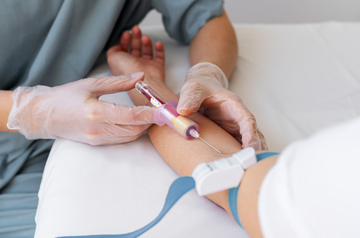 Flebotomi: Prosedur, Tujuan, dan Manfaatnya Bagi Kesehatan