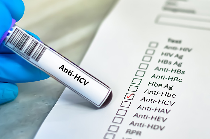 Tes Anti-HCV (EIA): Manfaat dan Prosedur | Halodoc
