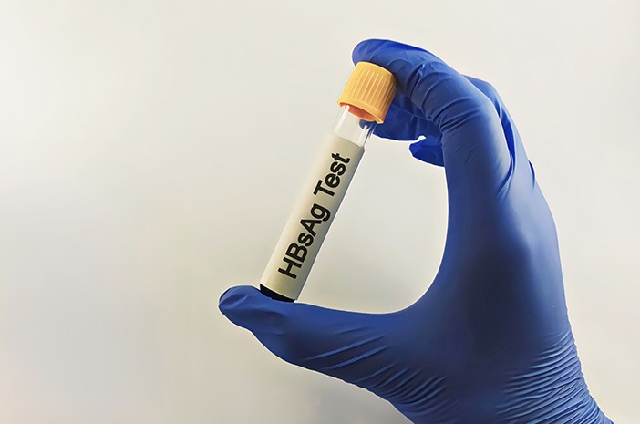 Tes HBsAg (EIA): Pengertian, Manfaat, dan Prosedur | Halodoc