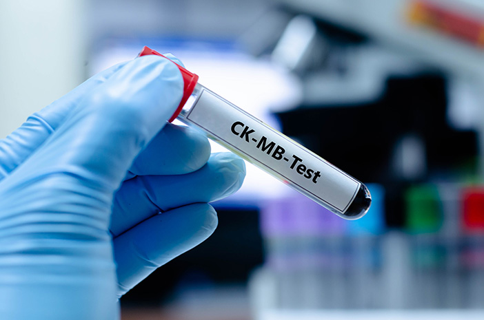 Cek Creatine Kinase-MB (CK-MB) - Prosedur dan Informasi Lengkap | Halodoc
