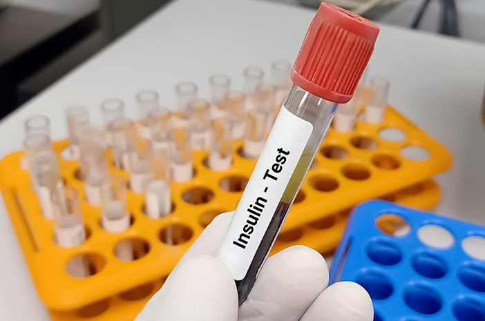 Cek Insulin Puasa - Prosedur dan Informasi Lengkap | Halodoc