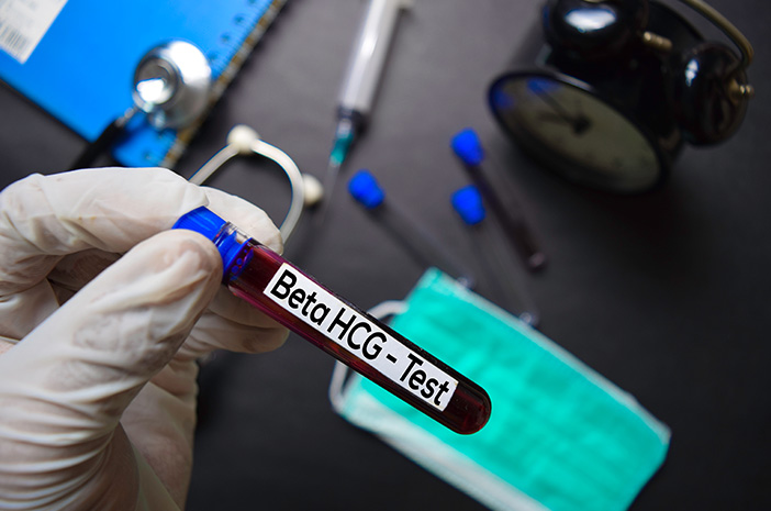Tes Beta-hCG (Serum) - Pengertian, Manfaat, dan Prosedur | Halodoc