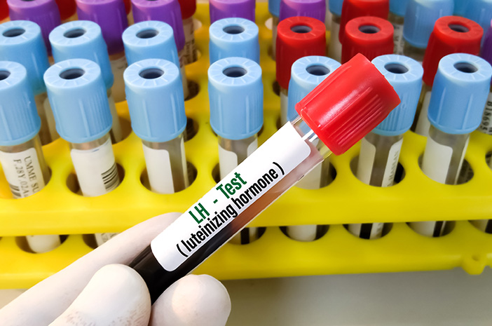 Cek Luteinizing Hormone (LH): Pengertian, Manfaat, dan Prosedur | Halodoc