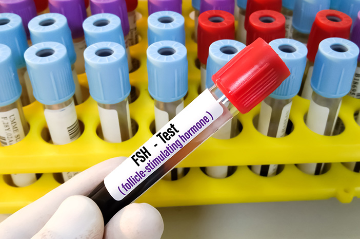 Cek Follicle Stimulating Hormone (FSH) - Prosedur dan Informasi Lengkap ...