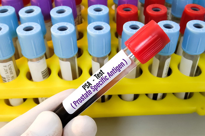 Cek Prostate-Specific Antigen (PSA): Pengertian, Manfaat, dan Prosedur ...