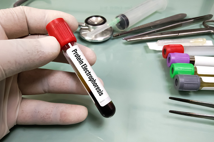 Cek Elektroforesis Protein: Pengertian, Manfaat, dan Prosedur | Halodoc